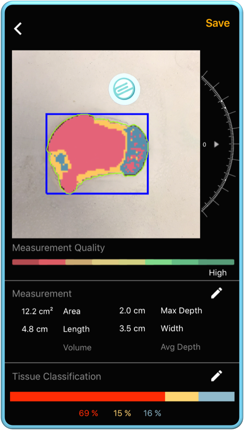 Wound Scan Results – eKare