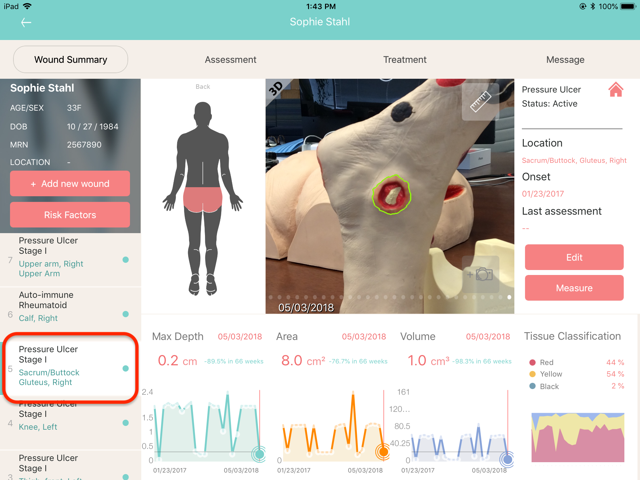 Measure Wound During Patient Revisit – eKare