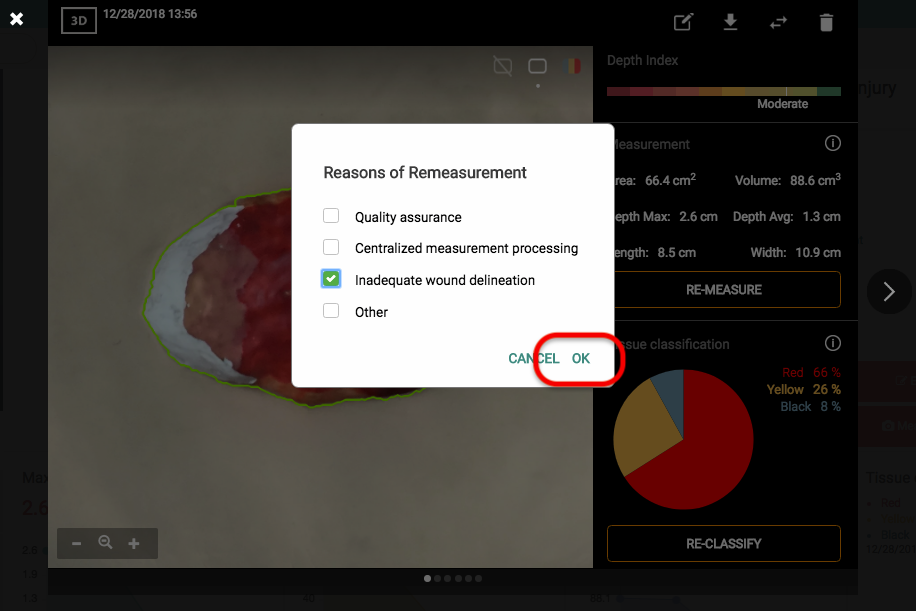 Redo Wound Measurement – eKare